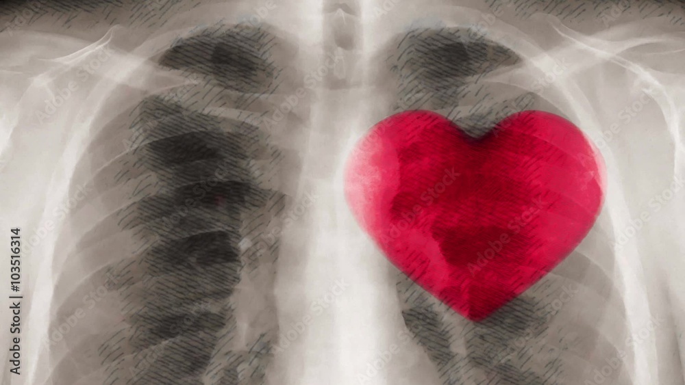 Cartoon x-ray of chest and beating heart. (loop ready file) vídeo de ...