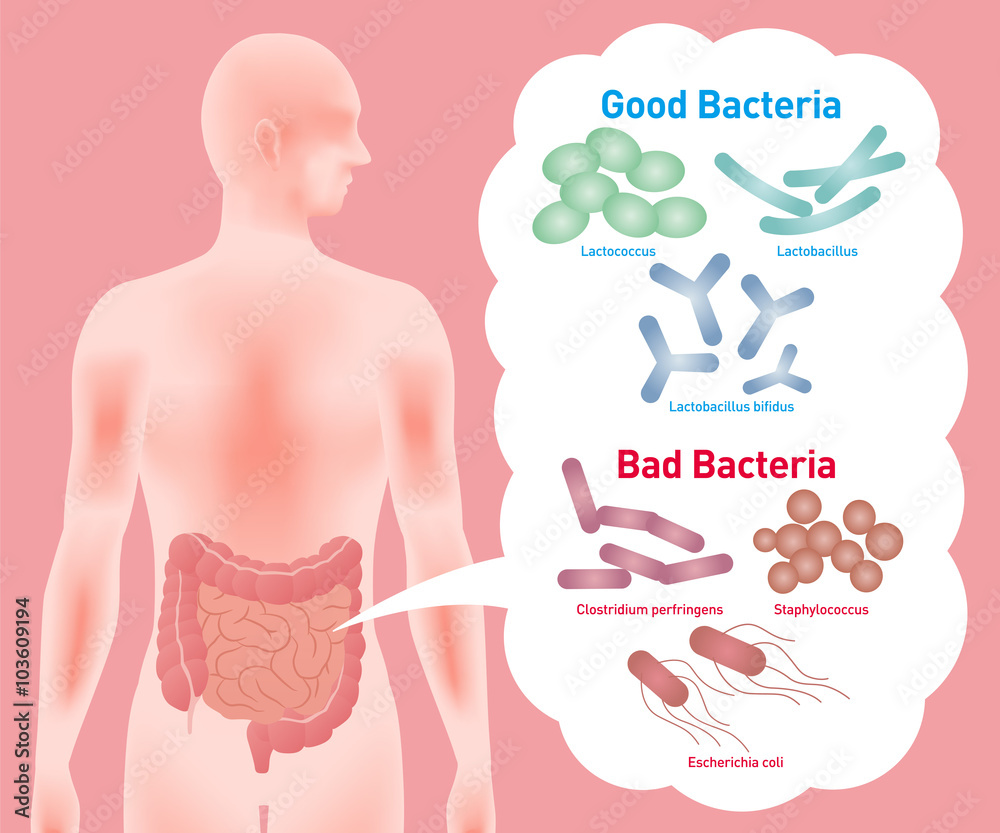 Good Bacteria and Bad Bacteria, enteric bacteria, Intestinal flora, Gut ...