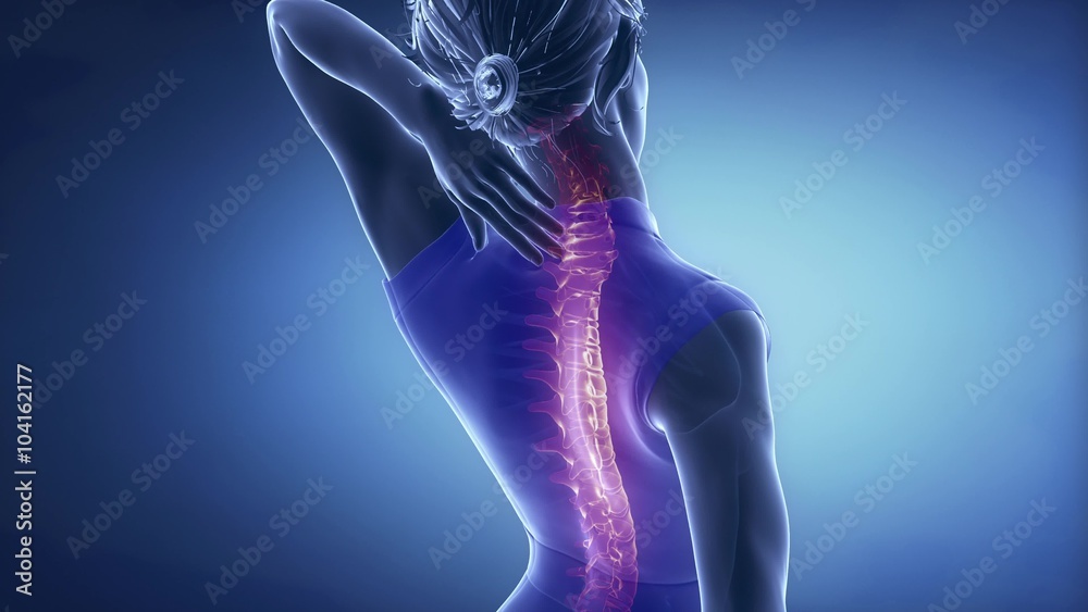 Vidéo Stock Female backbone pain - spine injury concept in blue | Adobe ...