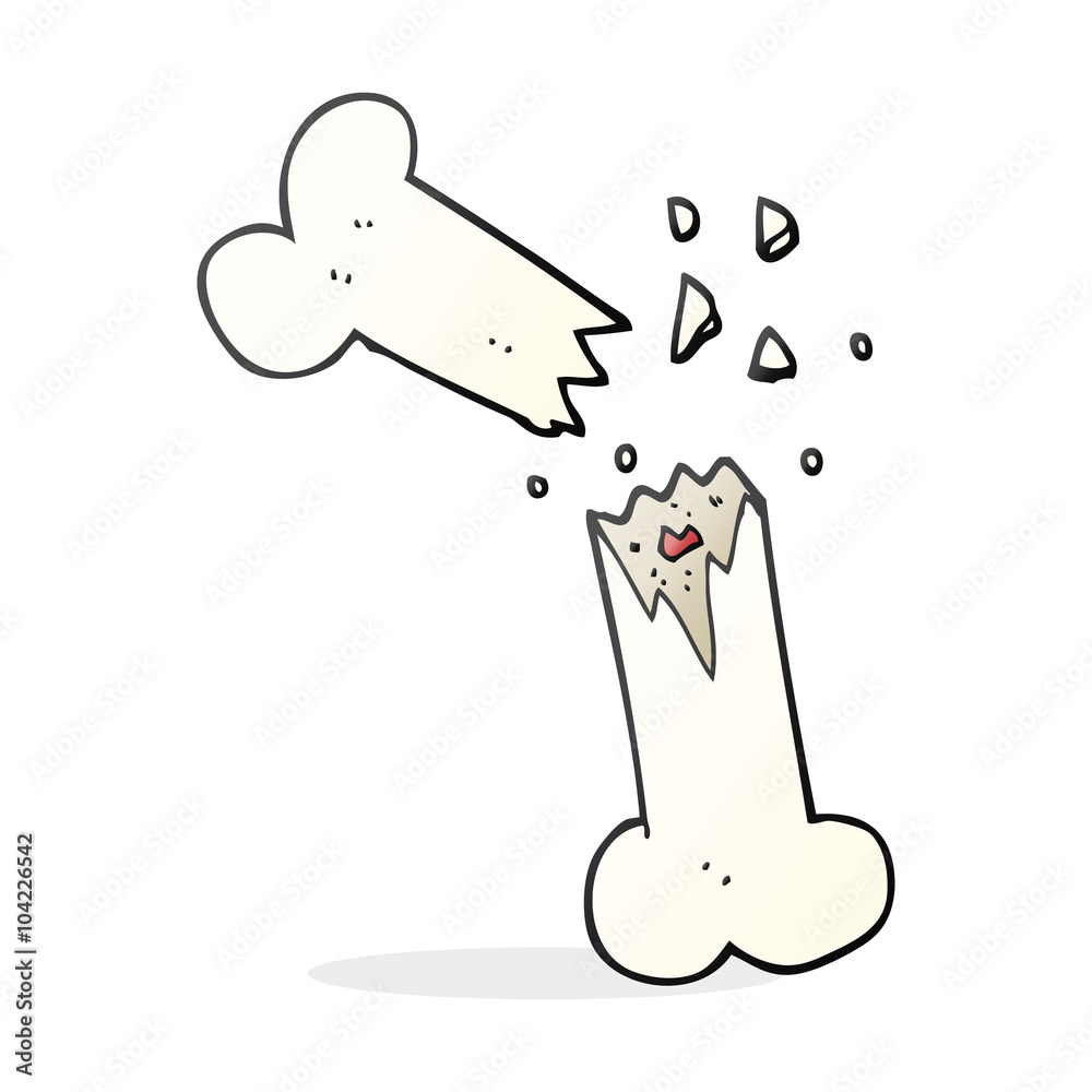 cartoon broken bone Stock Vector | Adobe Stock