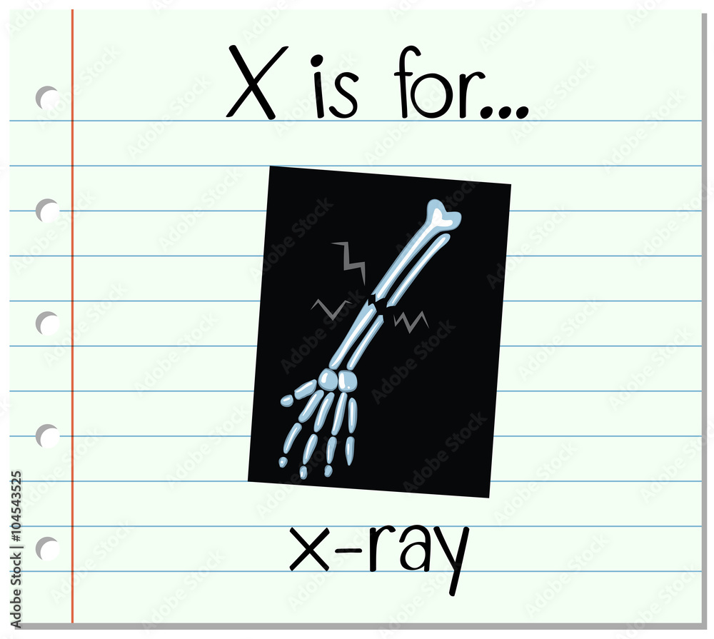 Flashcard letter X is for x-ray Stock Vector | Adobe Stock