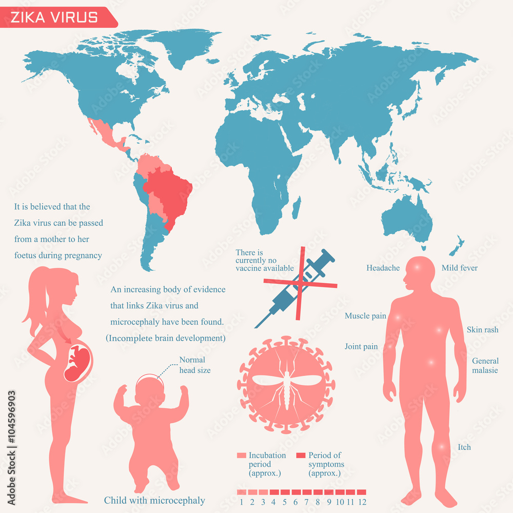 Zika virus disease infographic elements and symptoms. The virus is ...