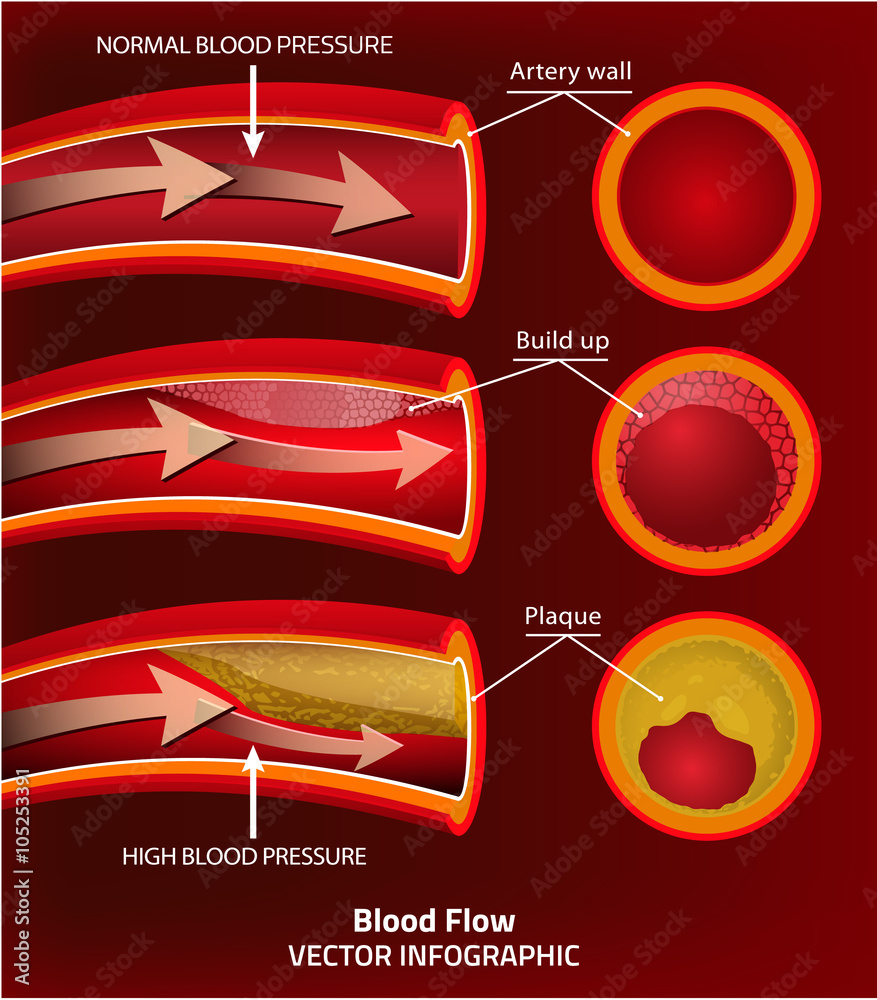 Blood Vector Image Stock Vector | Adobe Stock