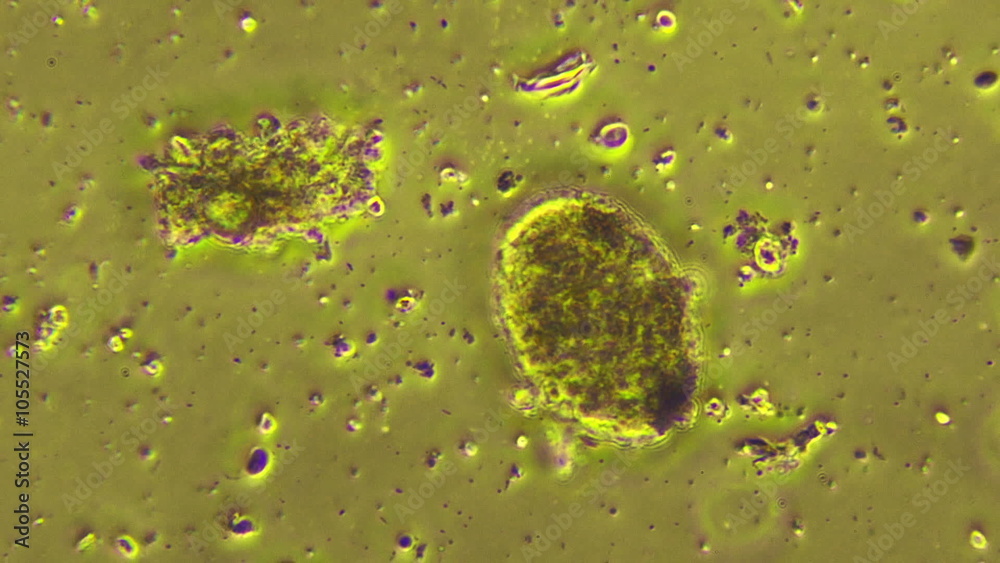 Dental Plaque Bacteria from human mouth seen in phase microscope 600x ...