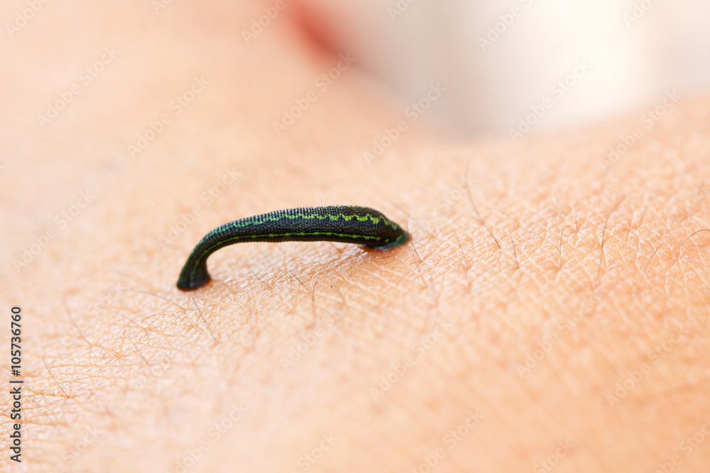 Leeches On Skin
