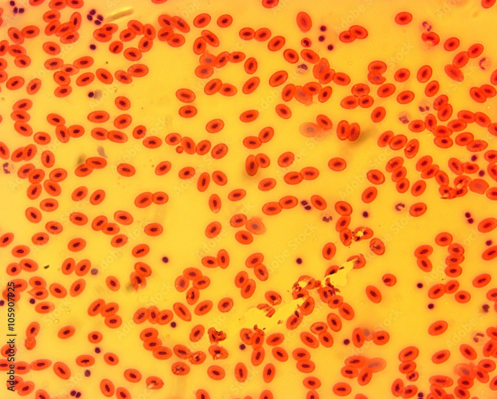 Frogs On A Red Cells Slide