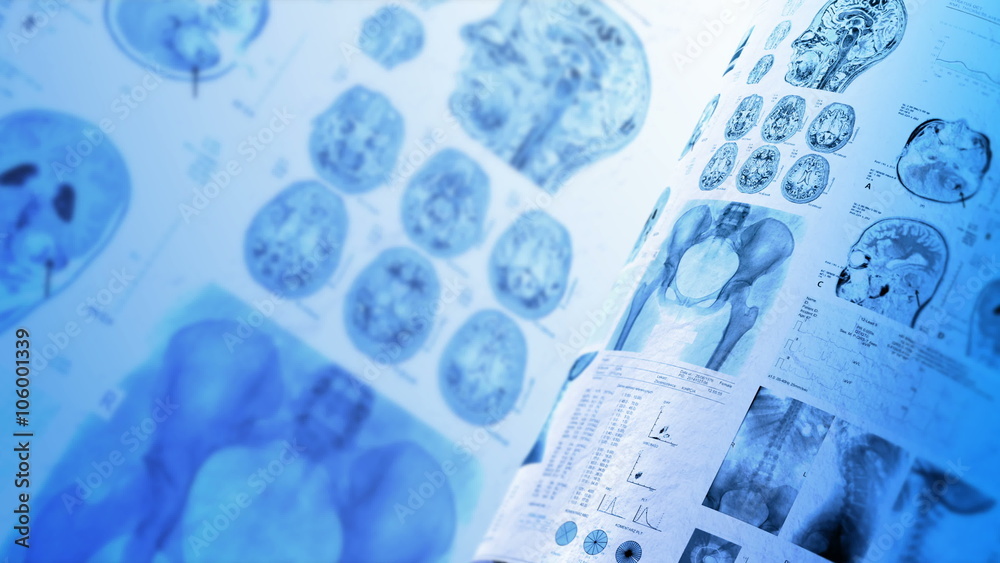 Medical, clinical background. Lab figures, charts, CT scans, X-ray ...