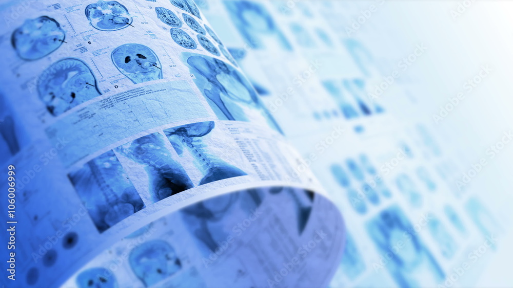 Medical, clinical background. Lab figures, charts, CT scans, X-ray ...