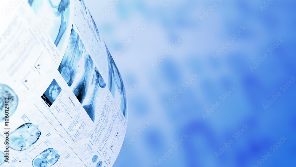 Medical, clinical background. Lab figures, charts, CT scans, X-ray ...