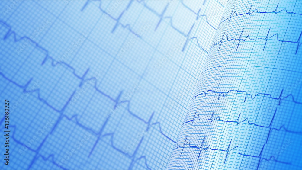 Heart rate, electrocardiogram, ECG medical background. LOOP. Blue ... Heart rate, electrocardiogram, ECG medical background. LOOP. Blue ...