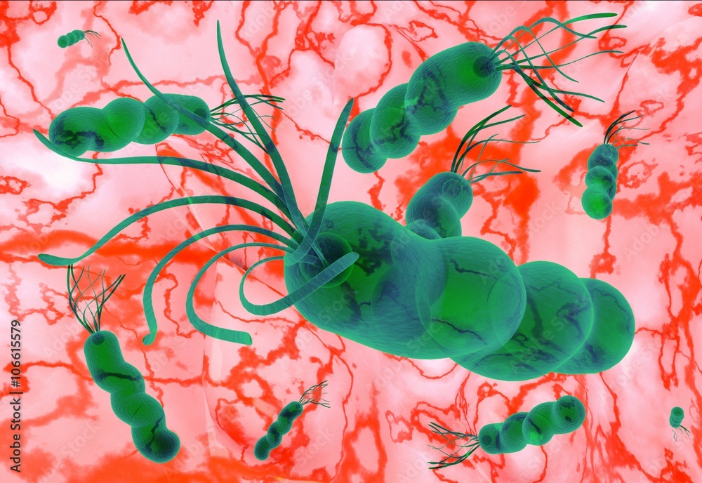 helicobacter pylori campylobacter germ that causes ulcers and stomach ...