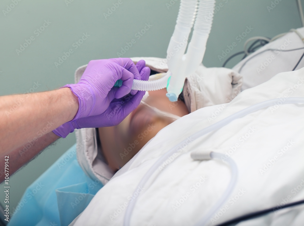 Tracheal intubation in the ICU Stock Photo | Adobe Stock