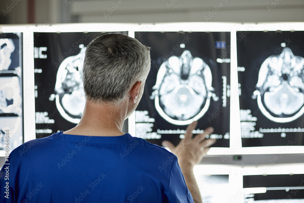 Rear view of radiologist examining the brain scans Stock Photo | Adobe ...