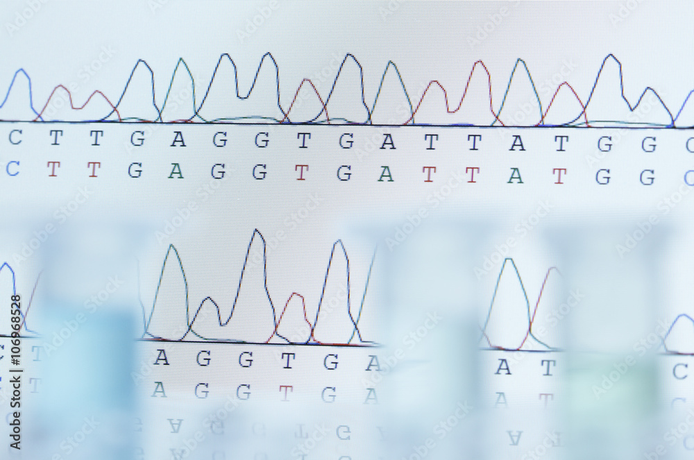 DNA sequencing. Computer monitor displaying results of automated DNA ...