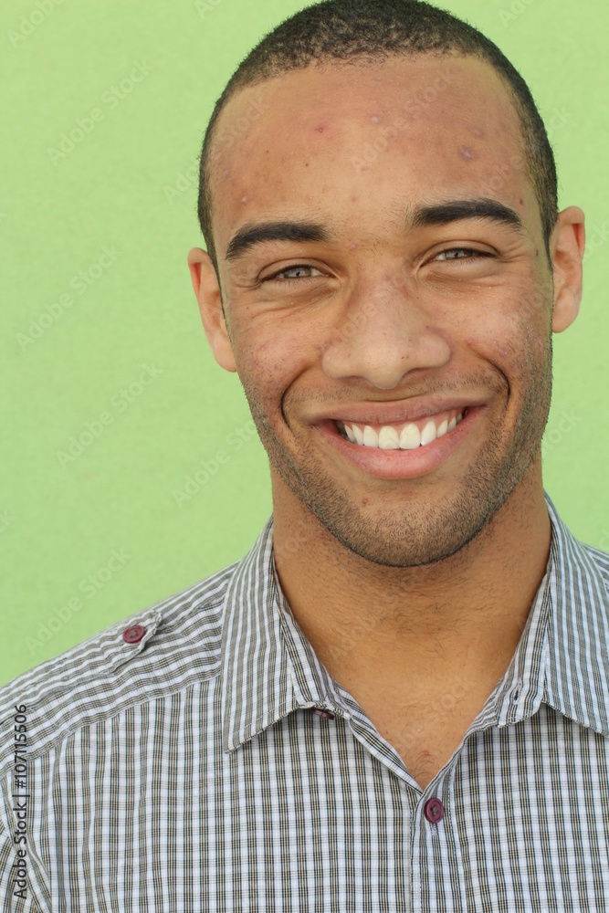Handsome ethnic young male with very bad facial acne foto de Stock ...