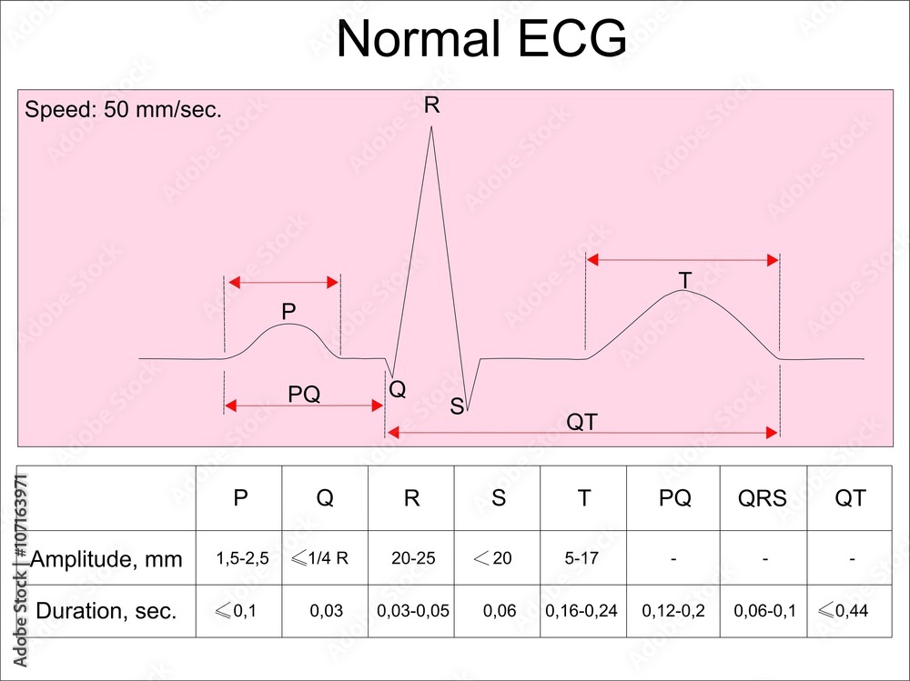Scheme of normal human ECG vector de Stock | Adobe Stock