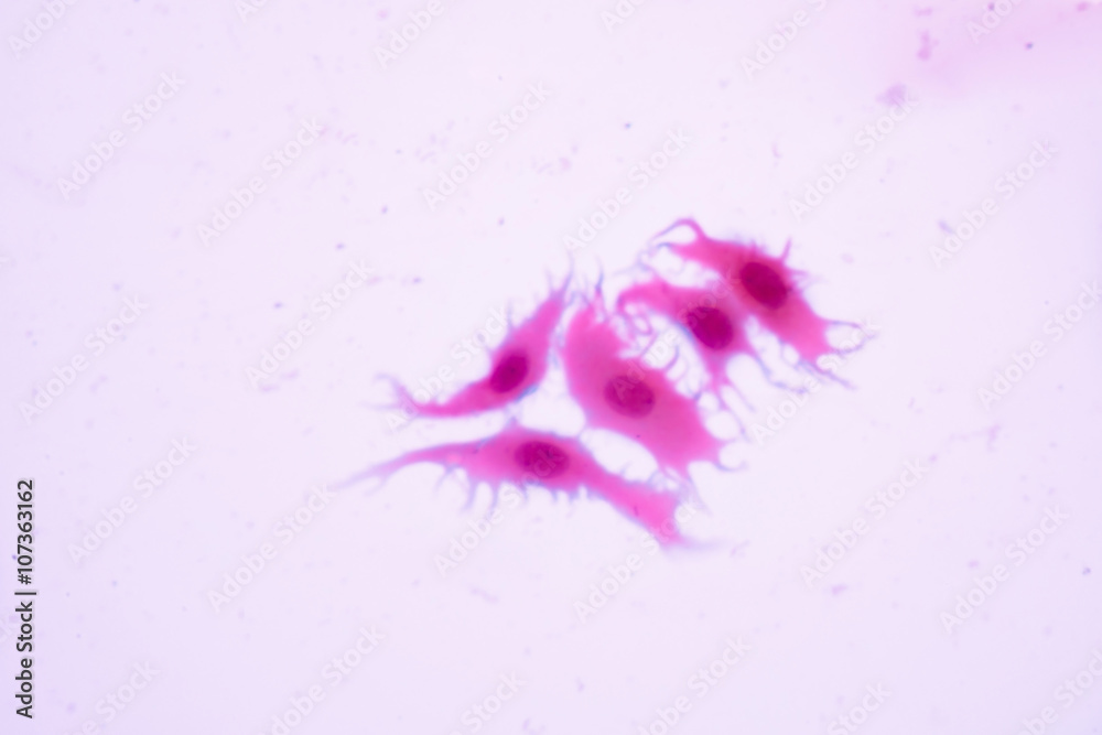 Human cells view in microscopy.Squamous metaplastic cells from pap ...