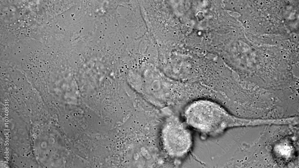 Movement, division and death of HeLa cervical cancer cells under ...