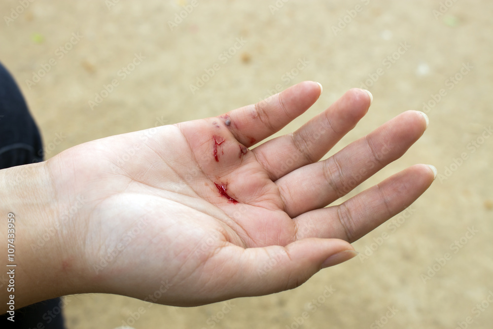 Monkey bite the hand, nature light and over [blur and select focus ...