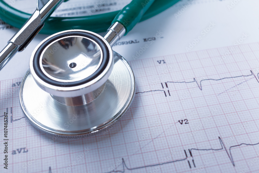 Stethoscope on an electrocardiogram (ECG) chart background Stock Photo ...