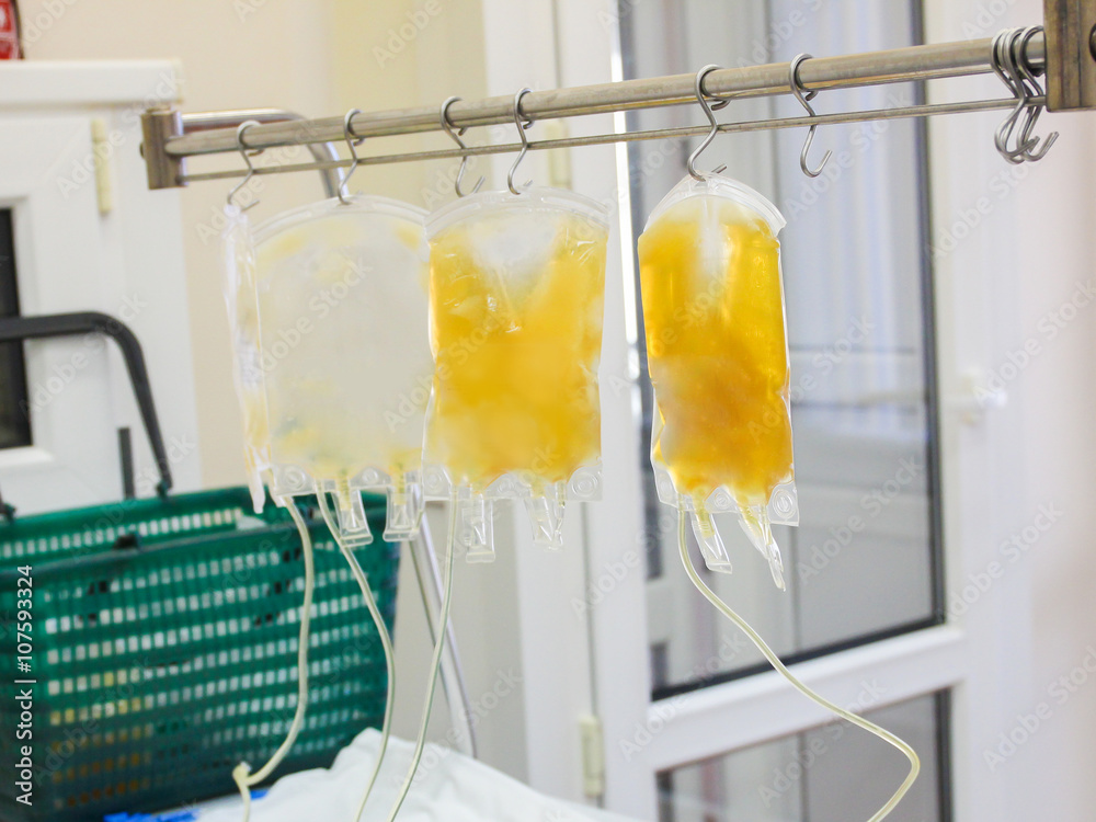 plasma package with this blood group. They are used in operations and ...