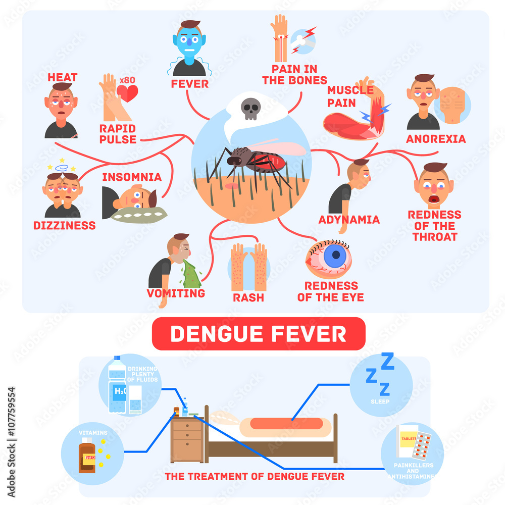 Dengue Fever Infographics Stock Vector | Adobe Stock