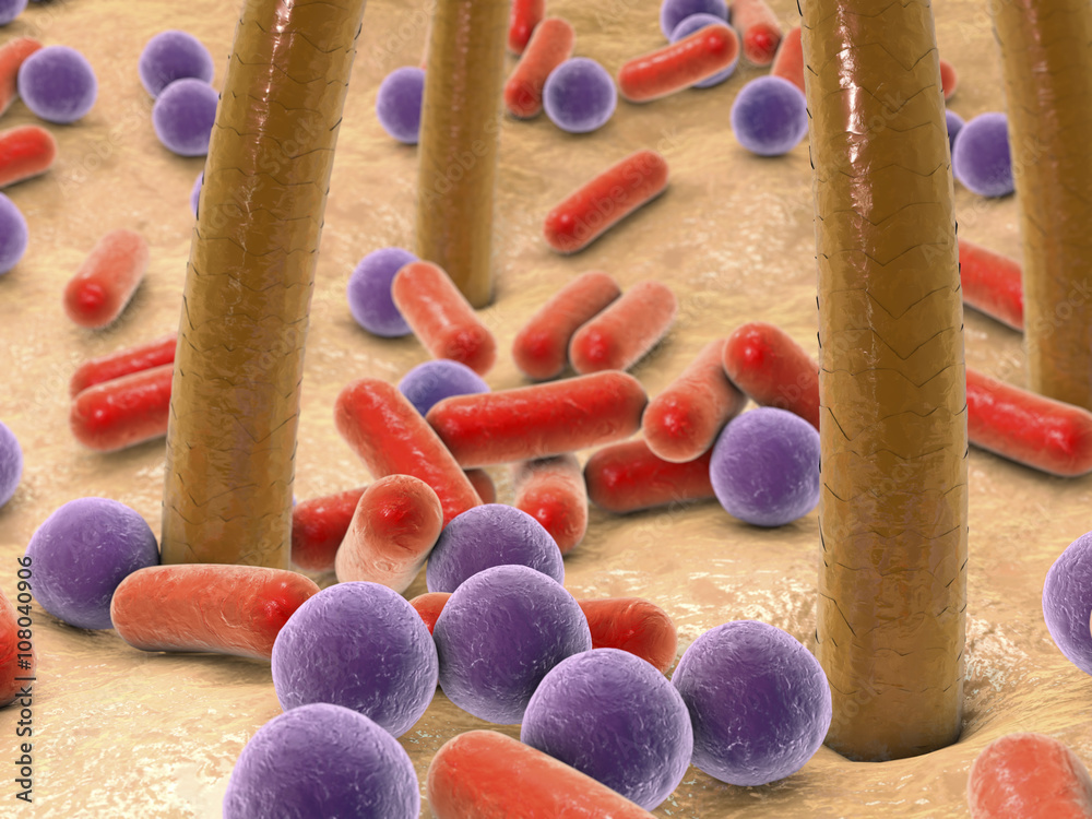 3D illustration of spherical and rod-shaped bacteria on skin with hairs ...