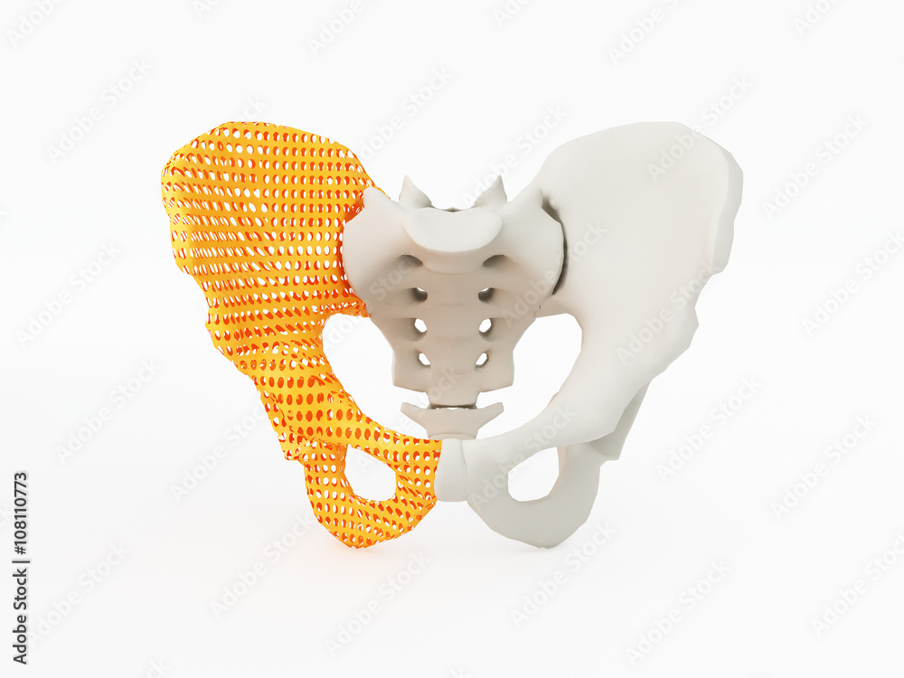 3d printed hip bone. 3d printed implants on white background. 3d ...