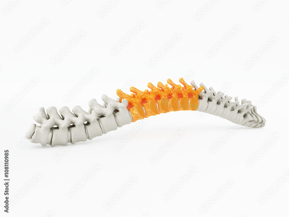 3d printed human spine. 3d printed implants on white background. 3d ...