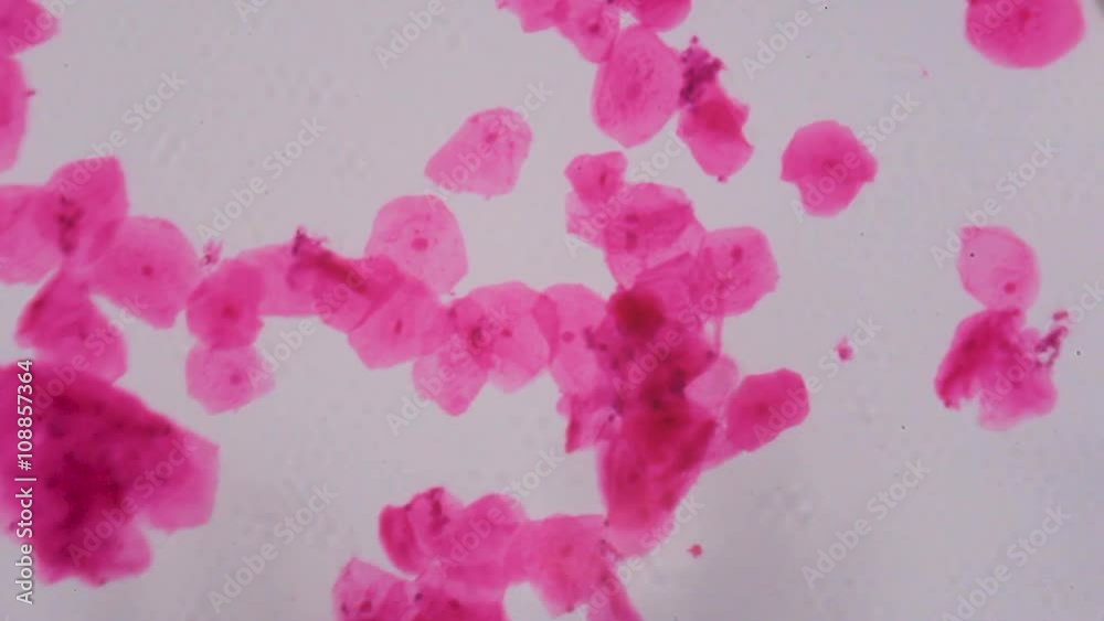 Multiple squamous epithelium under the microscope - Abstract pink dots ...