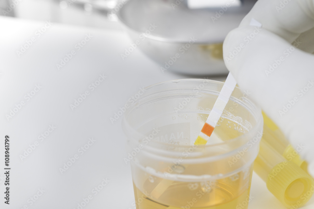 Routine test, urine rapid test, urine test strip, urine sample Stock ...
