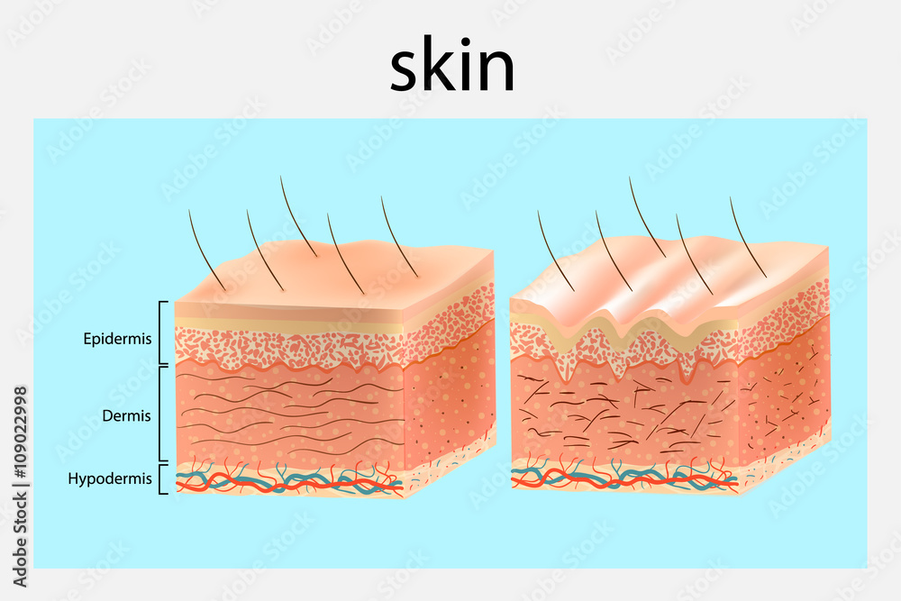 The structure of the skin. Younger skin and aging skin. Vector diagram ...