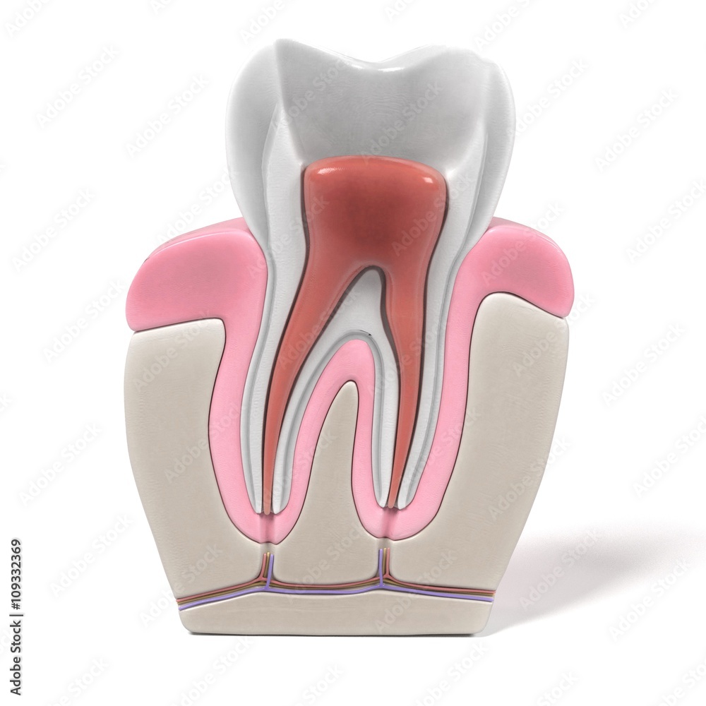 3d renderings of endodontics - root canal procedure Stock Illustration ...