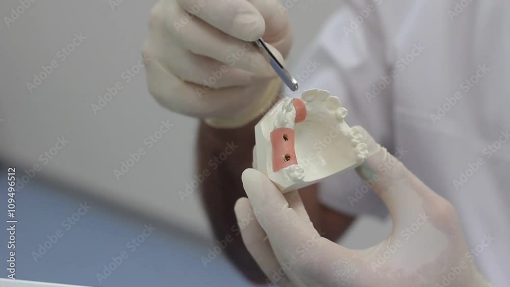 Dental Prosthetic Jaw vídeo do Stock | Adobe Stock