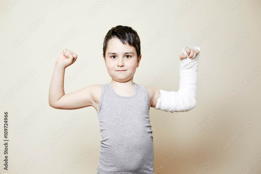 cute boy with broken arm Stock Photo | Adobe Stock