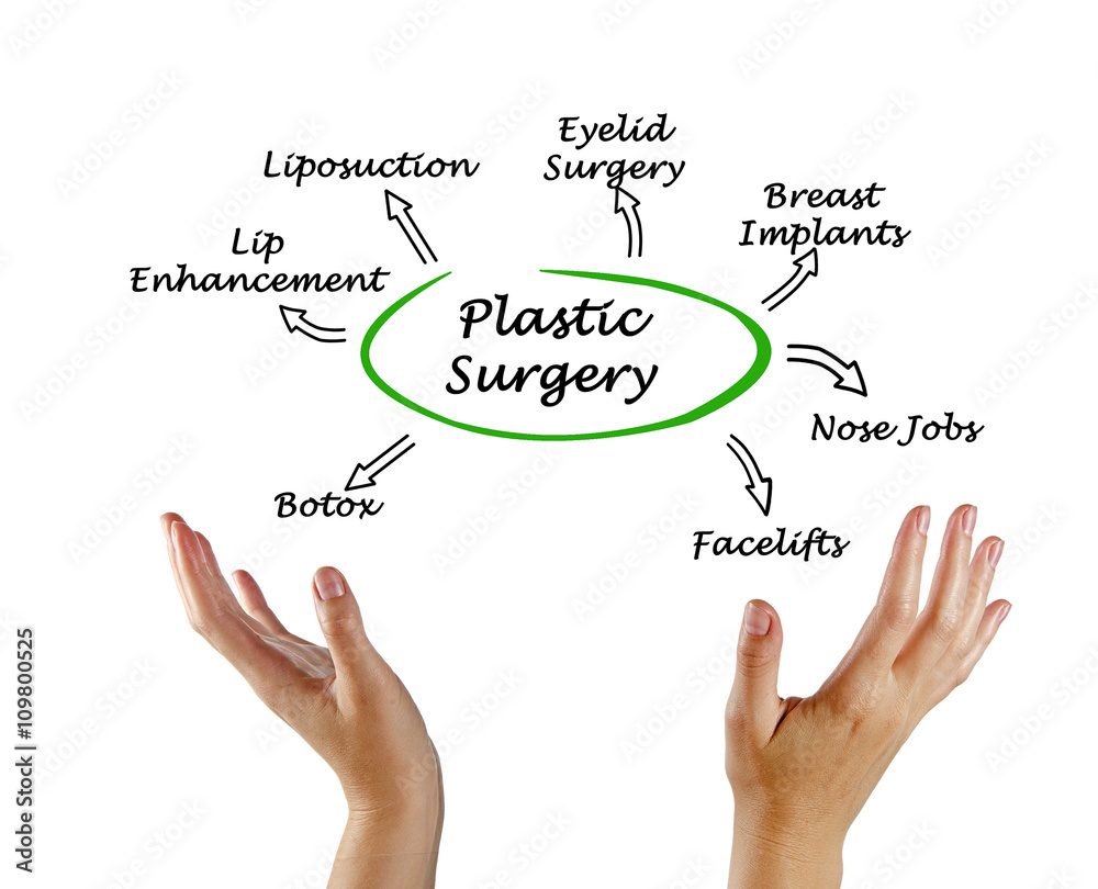 Diagram of Plastic Surgery Stock Photo | Adobe Stock
