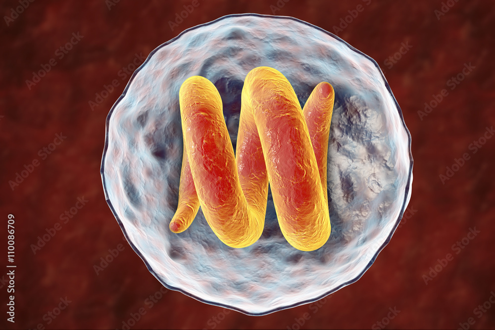 Cyst containing roundworm Trichina spiralis (formely called Trichinella ...