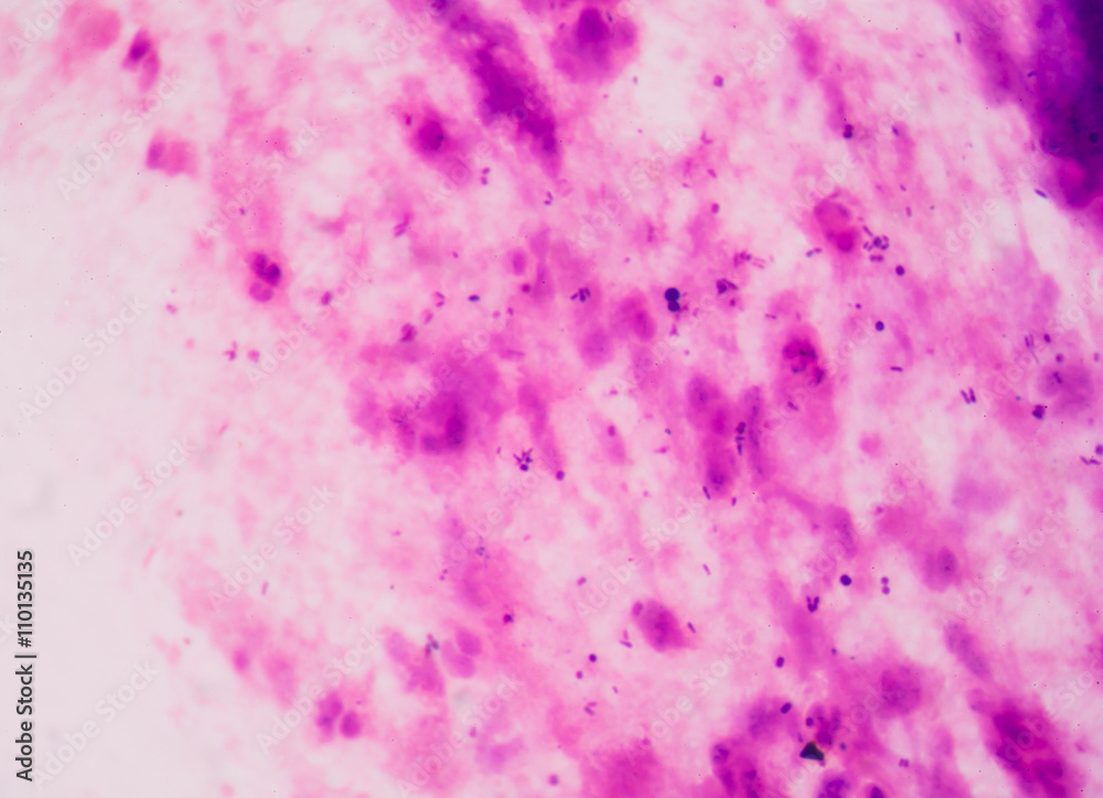 bacteria cells on pink background. Stock Photo | Adobe Stock