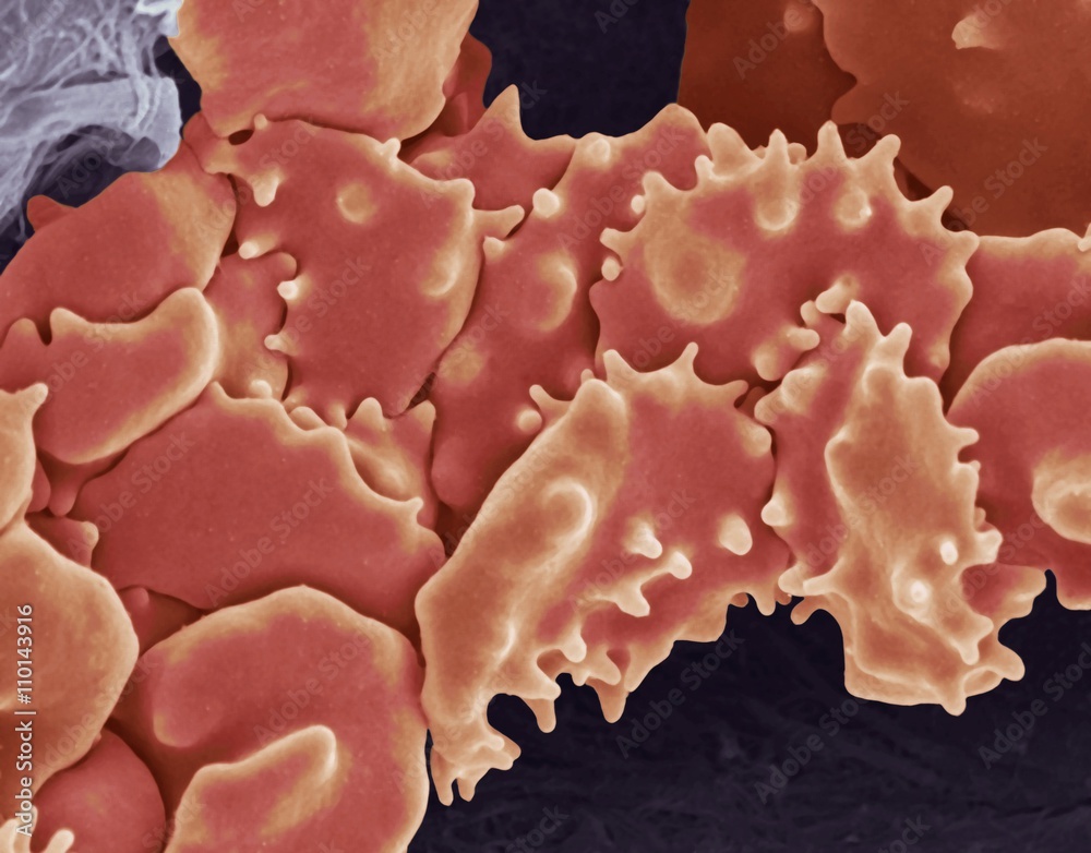 Crenated red blood cells, SEM Stock Photo | Adobe Stock