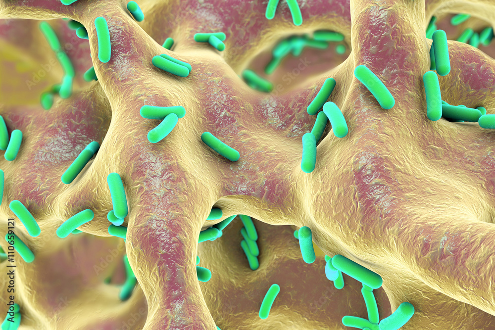 Bacteria inside human body. Rod-shaped bacteria inside bone tissue ...