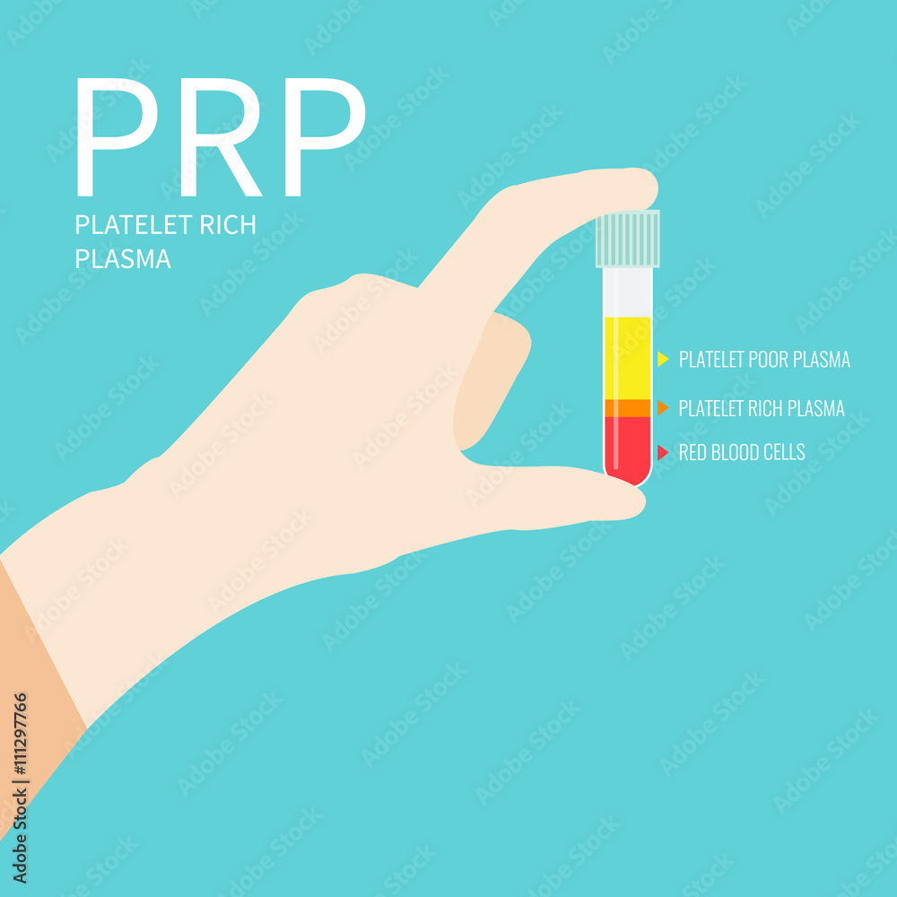 PRP poster with place for text. Hand holding a test tube filled with ...