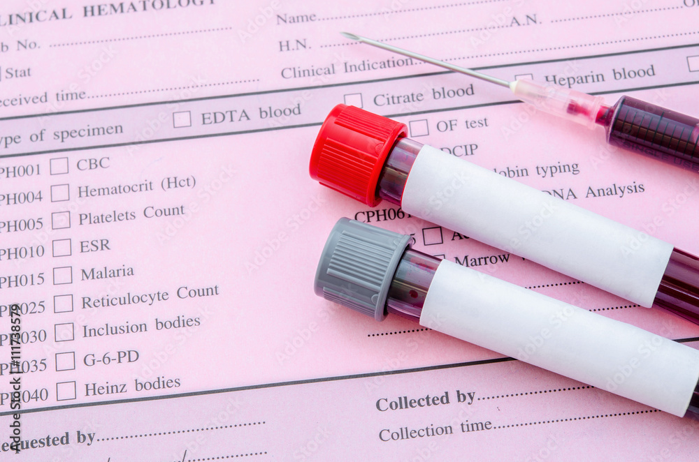 Blood vial with blood sample with syringe. Stock Photo | Adobe Stock