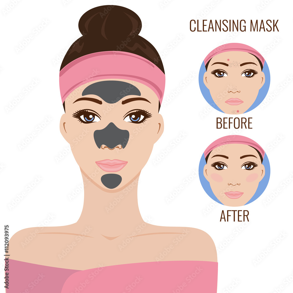 Cleans pores strip. Beautiful young women with cleansing mask. Before ...