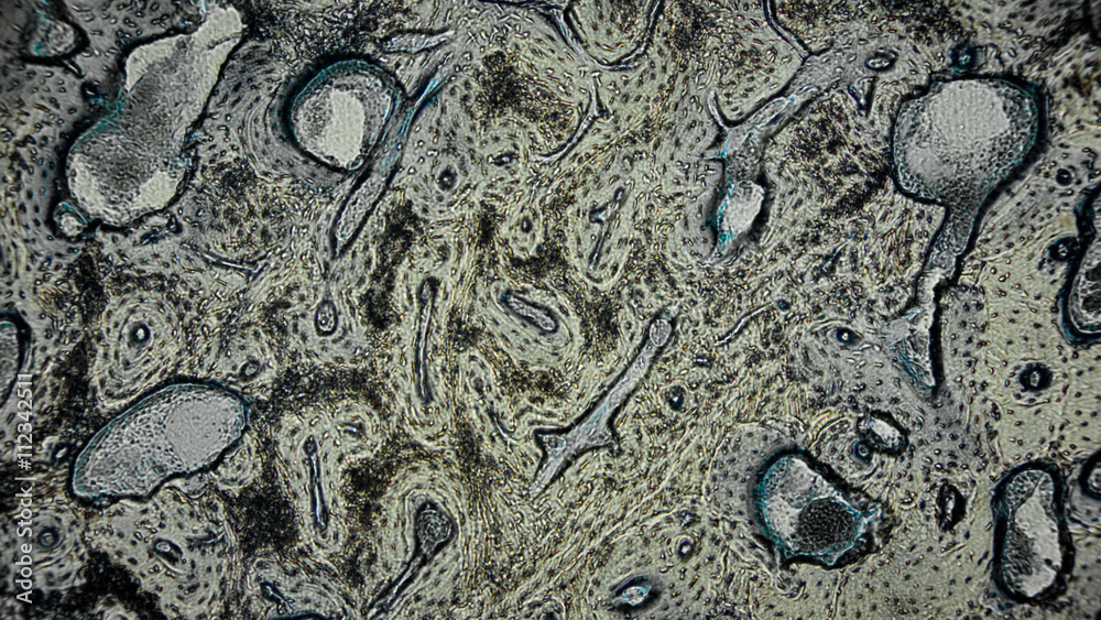 menschliche Zellen unter dem Mikroskop - Anatomie / Histologie ...