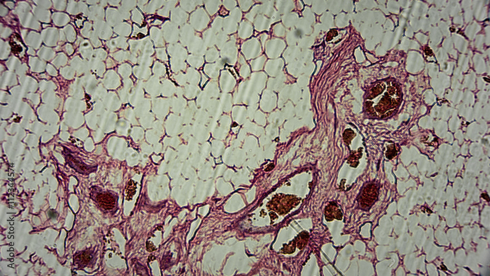 menschliche Zellen unter dem Mikroskop - Anatomie / Histologie ...