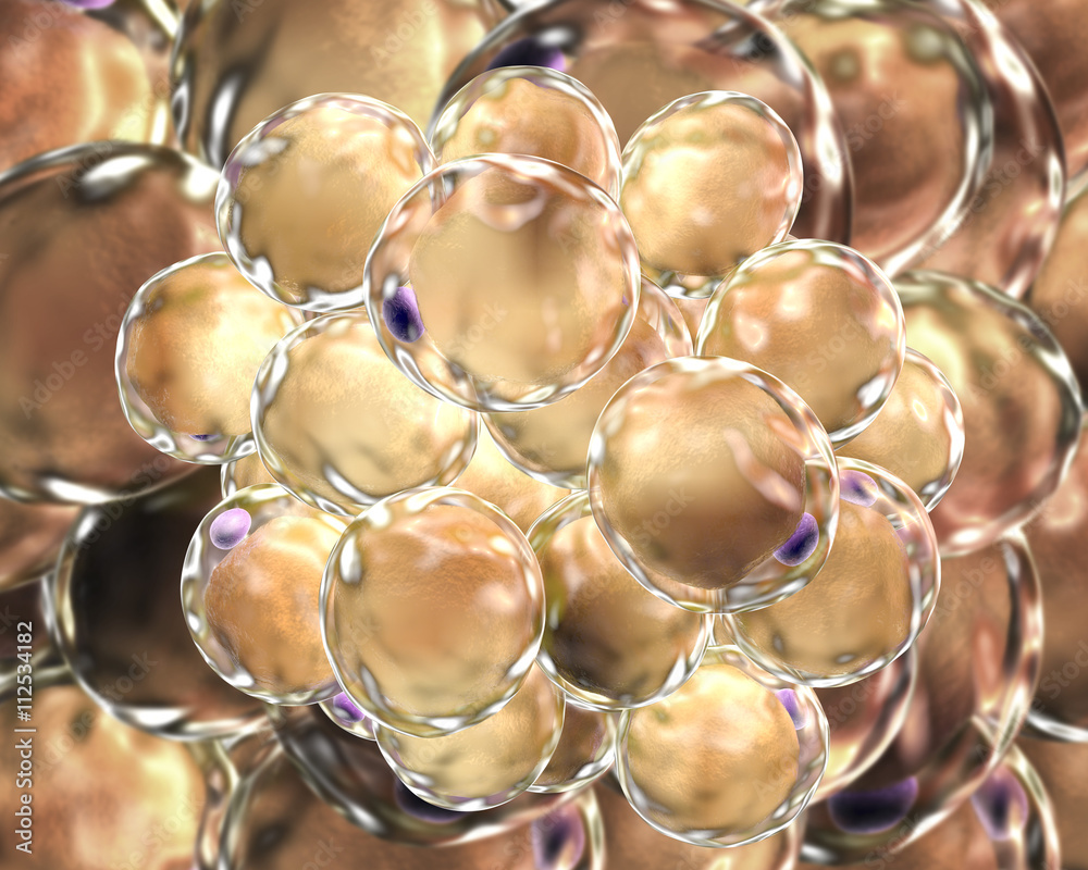 Fat cells. 3D illustration showing presence of big lipid droplet ...
