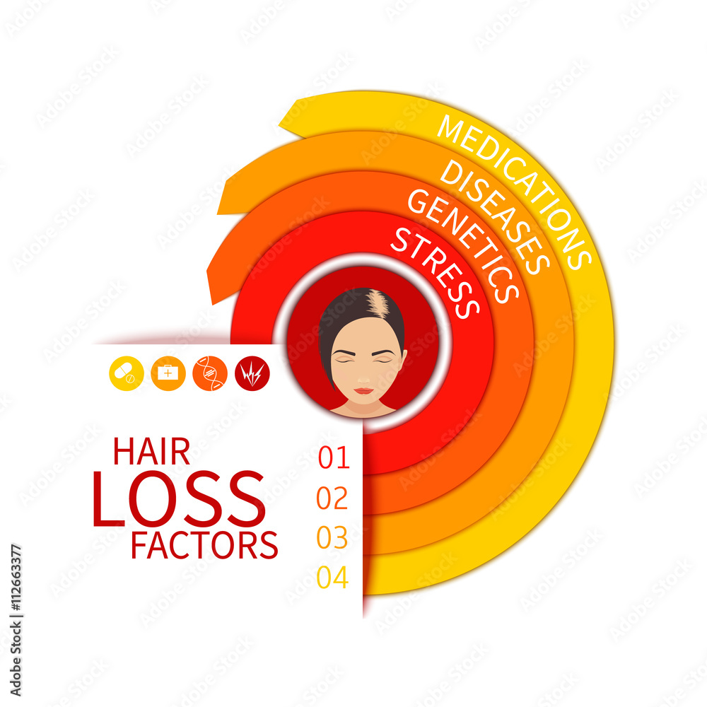 Hair Loss Risk Factors Infographic Arrow Medical Chart Four Hair Loss Reasons Stress