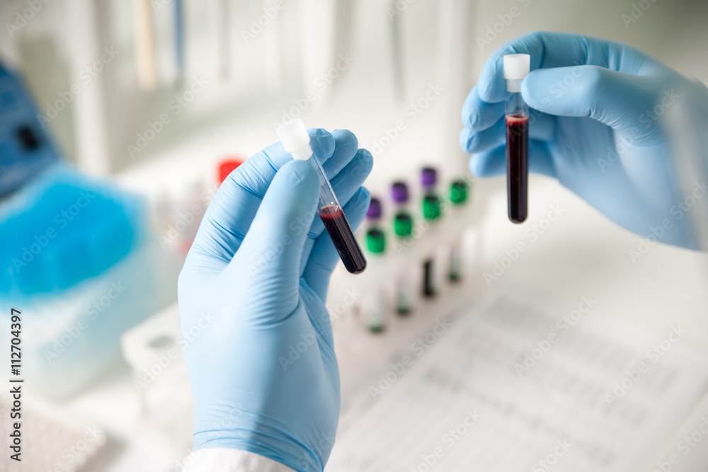 Laboratory scientist looking at test tubes with blood and analysis ...