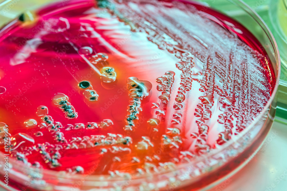 Bacterial colonies culture on selective agar media(SS agar). Stock ...