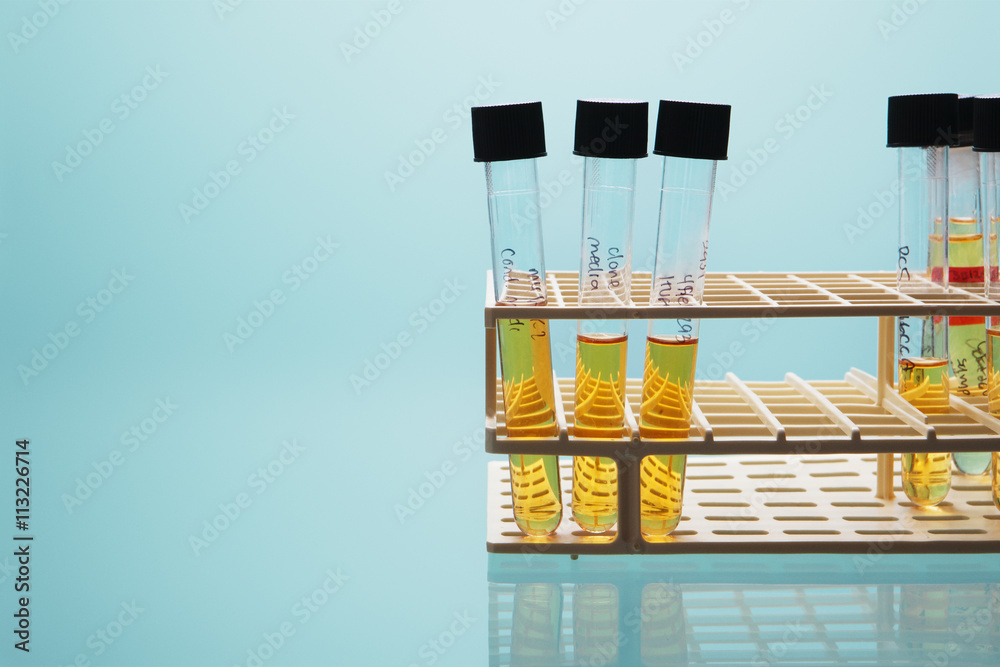 Close up of test tubes in rack against blue background Stock Photo ...